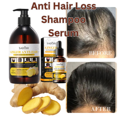 Anti Hair Loss Shampoo Ginger Set 1 Bottle Shampoo 500ml + 1 Bottle ...
